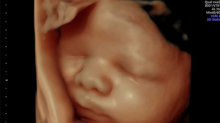 The Differences Between 2D, 3D, and 4D Ultrasounds Explained - Focus on the Family